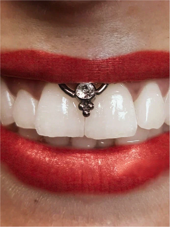 How Long Do Smiley Piercings Last? Lifespan, Healing & What to Expect ...